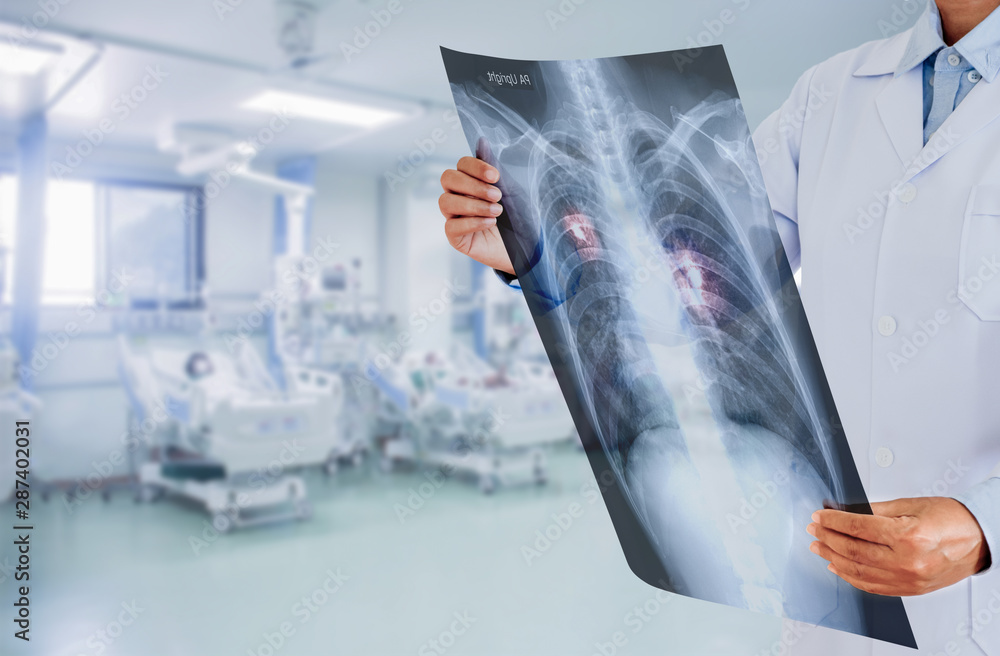 Lung Cancer. Doctor checking up x-ray image have problem lung tumor of ...