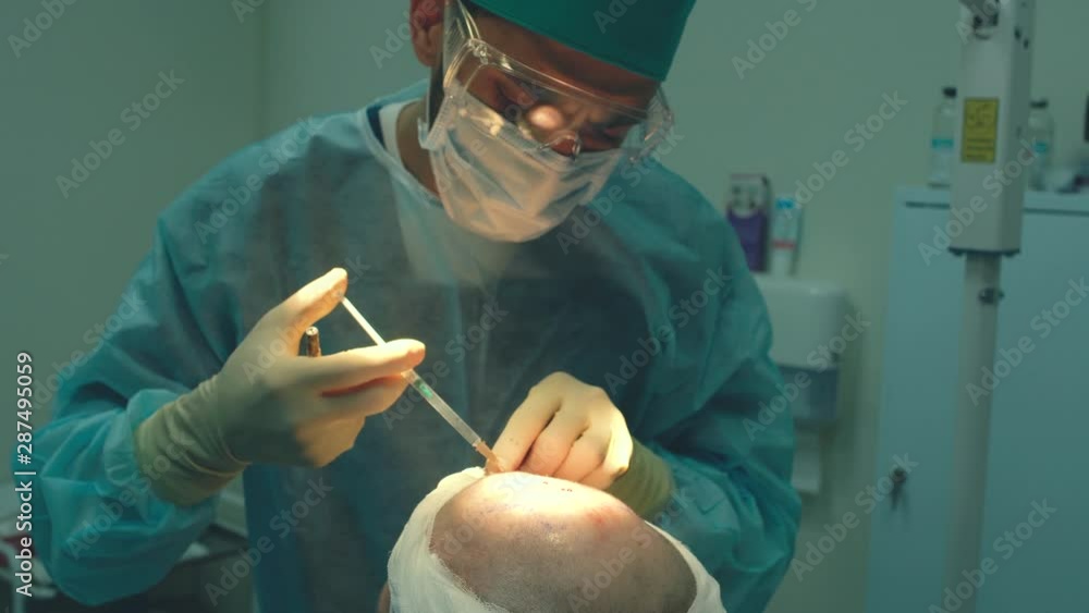 Baldness treatment. Hair transplant. Surgeons in the operating room ...