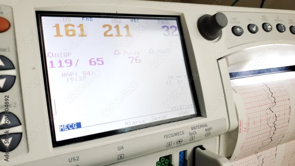 Heart rate monitor for twin babies. Two counters display the heart ...