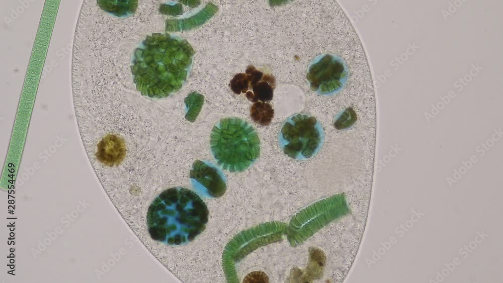 Frontonia sp. is a genus of free-living unicellular ciliate protists ...