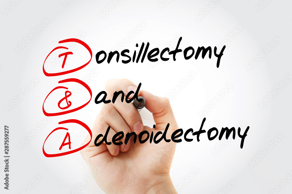 T&A - Tonsillectomy and Adenoidectomy acronym with marker, concept ...