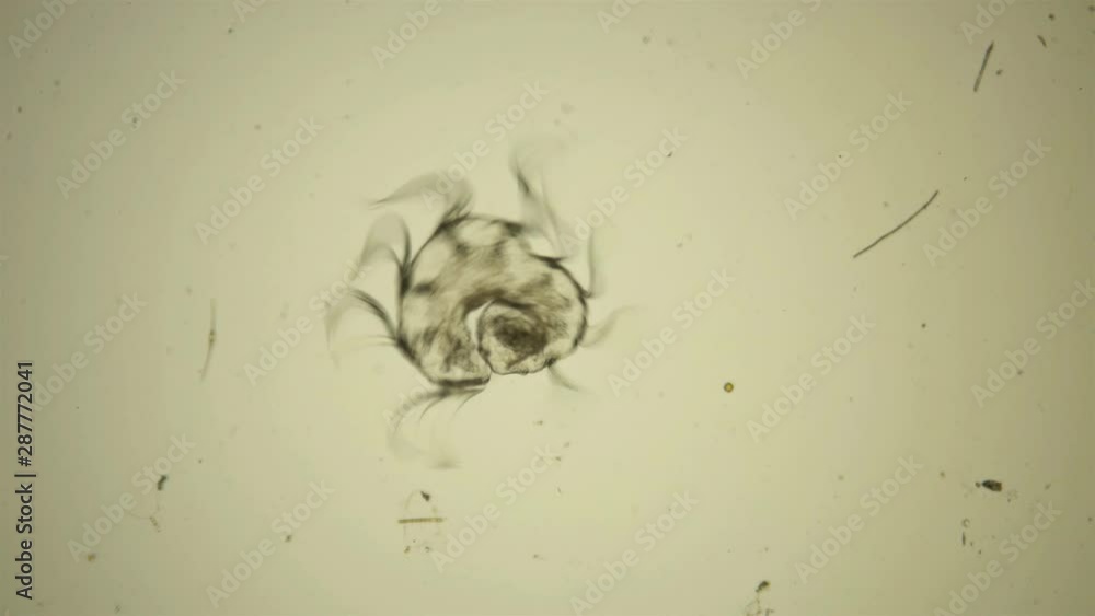 Zooplankton and plankton of the Black Sea. The larva of the ctenophore ...