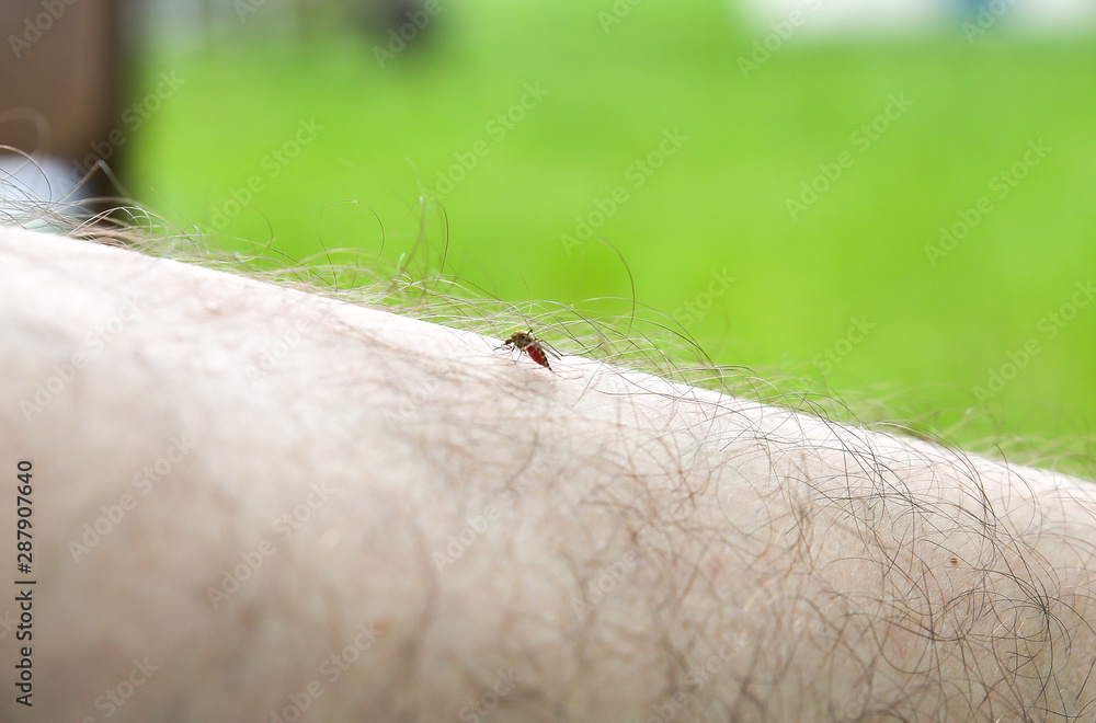 Mosquito sitting on the leg. Insects bite in the summer. Dangerous ...