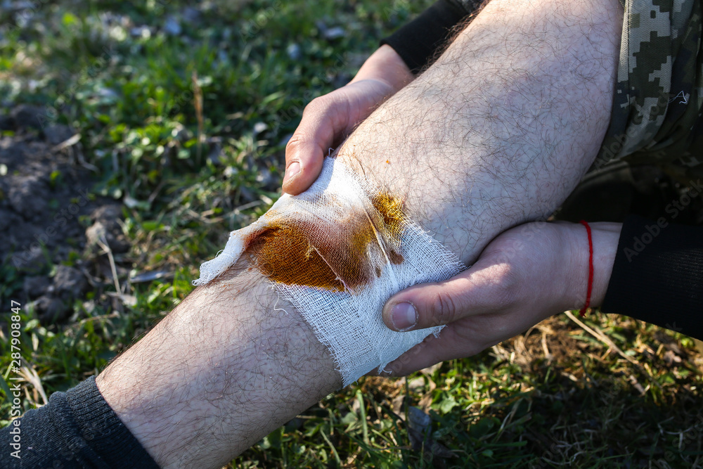 Man is putting bandage on bleeding wound. Injured leg. Tourist in the ...