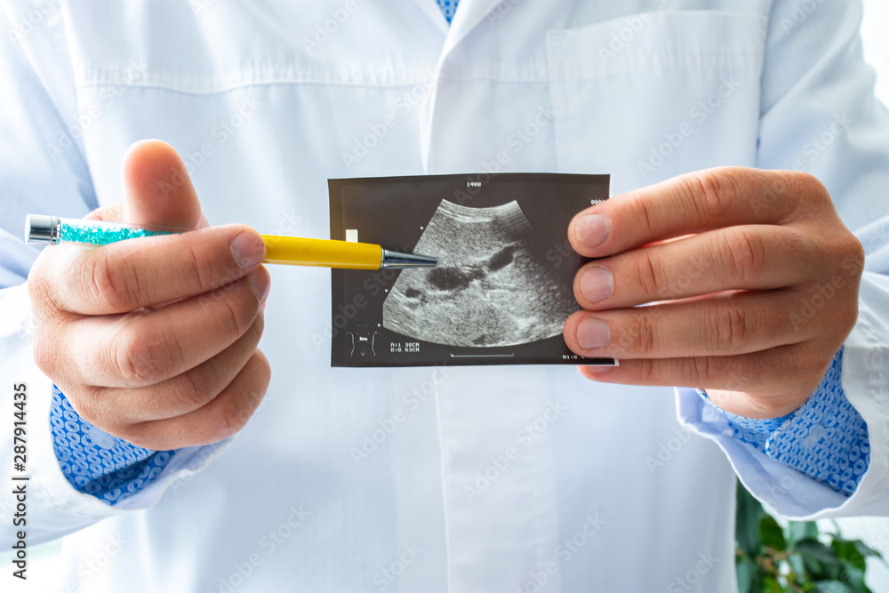 Doctor holds before itself and shows patient printed picture with ...
