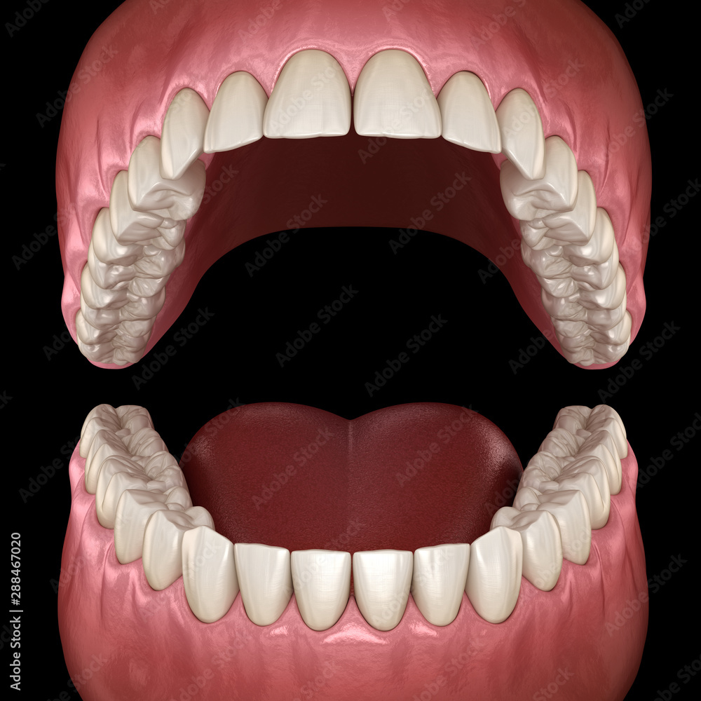 Dental anatomy - Opened Dentures. Medically accurate dental 3D ...