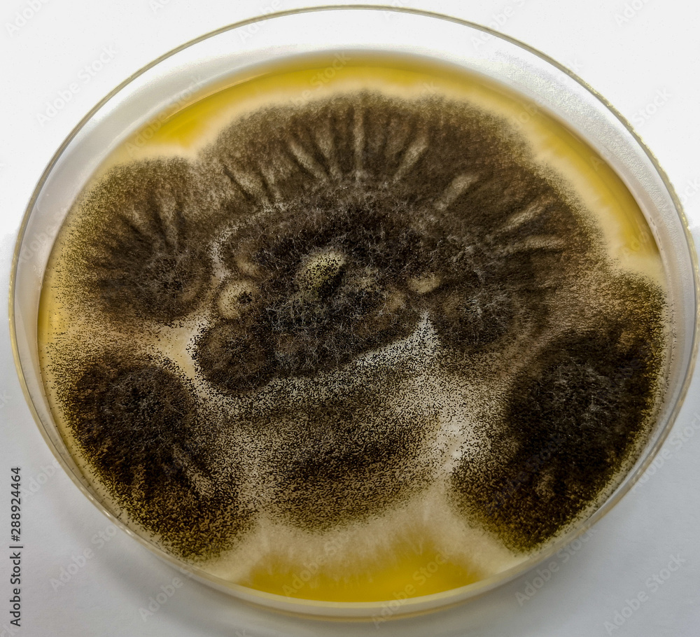 Foto de Aspergillus niger on Sabouraud's dextrose agar (SDA) at 25 ...