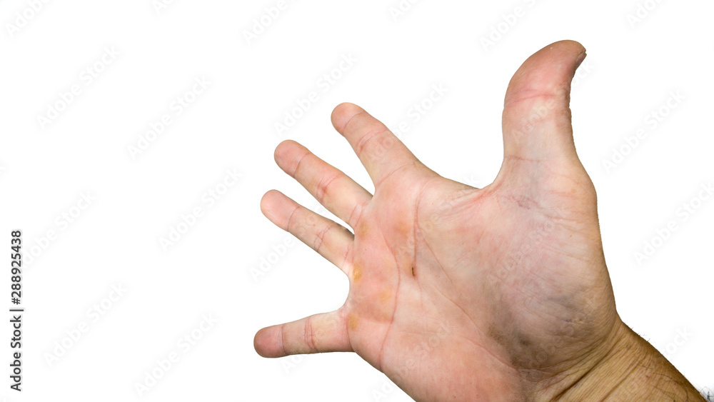 Dirty Hand Signs