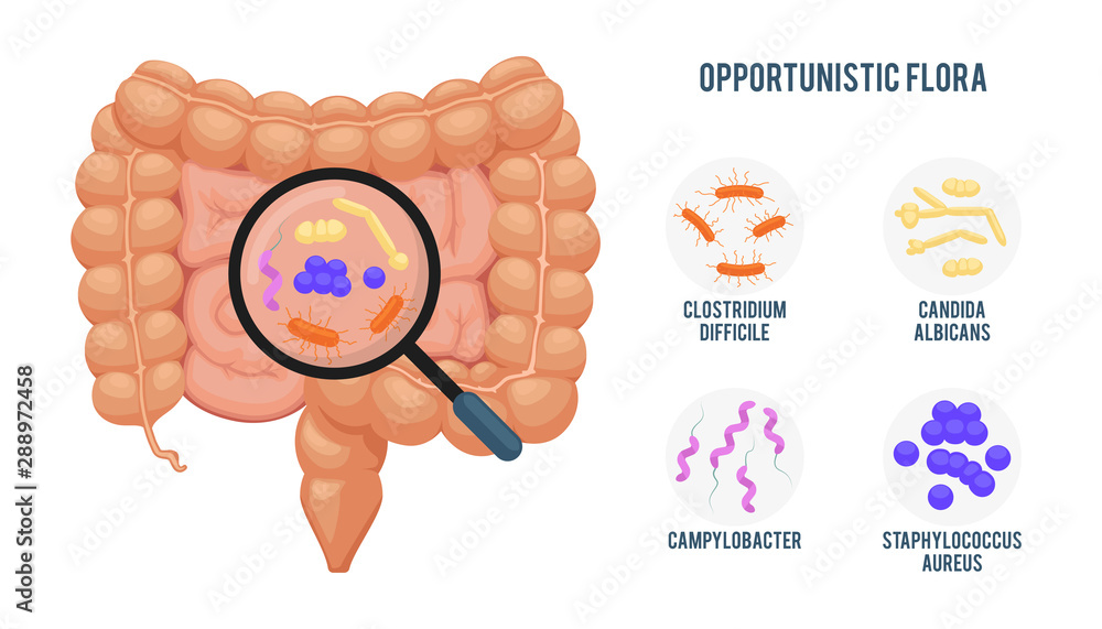 Poster Realistic flat vector illustration:intestine, gut microflora ...