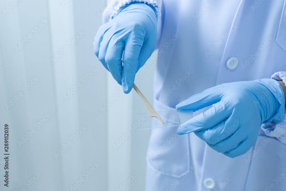 Doctor hand holding spatula and glass slide cytology set.Gynecologist ...