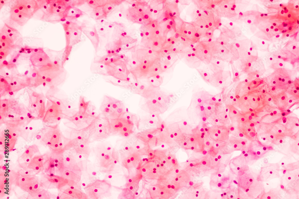 View in microscopic of normal human cervix cells.Squamous epithelium ...