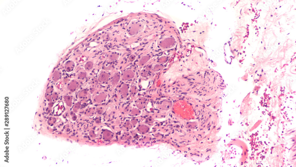 Foto de Histology of a peripheral nerve ganglion. Ganglia such as this ...
