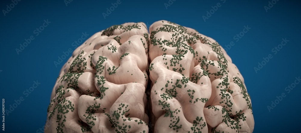 Brain infected with parasites, viruses or bacteria. Stock Illustration ...