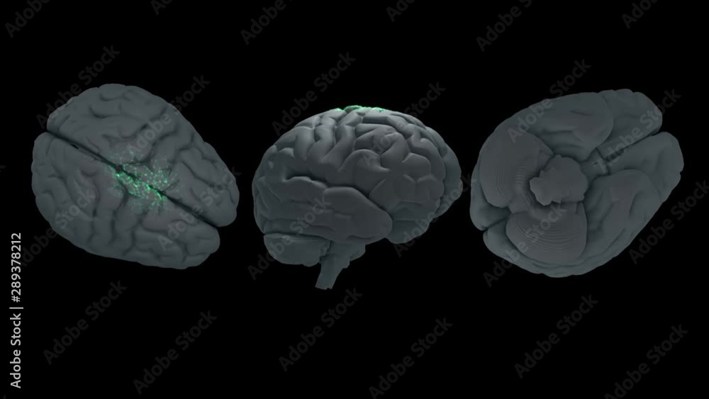 3 Views of 3D Wireframe laser scan of human brain with Rotating 360 ...