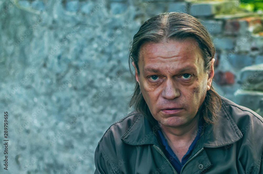 a homeless man with a bruise on his cheek sitting in the ruins. Poverty ...