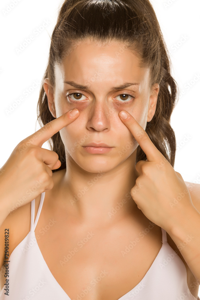 Young woman touching her low eyelids on yellow background Stock Photo ...