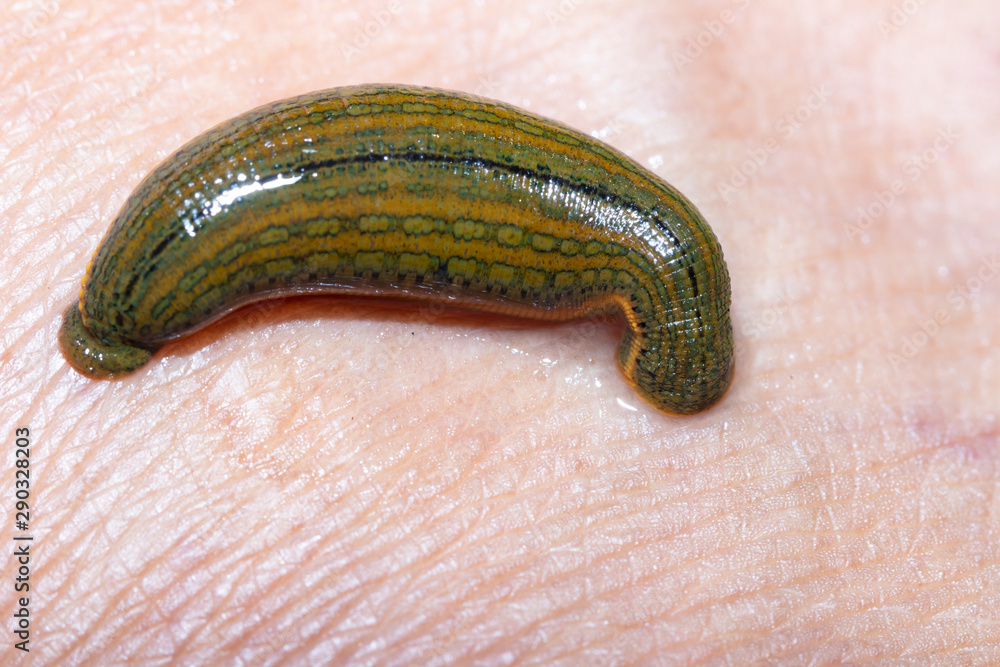 Aquatic Leech sucking blood on skin,Leeches were used in medicine from ...