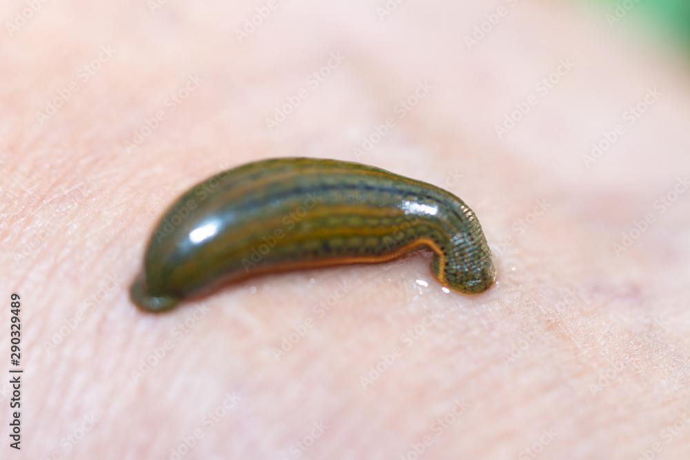 Aquatic Leech sucking blood on skin,Leeches were used in medicine from ...