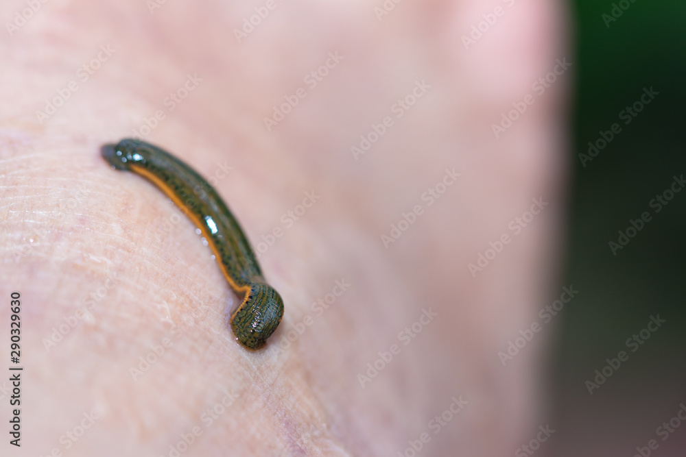Aquatic Leech sucking blood on skin,Leeches were used in medicine from ...