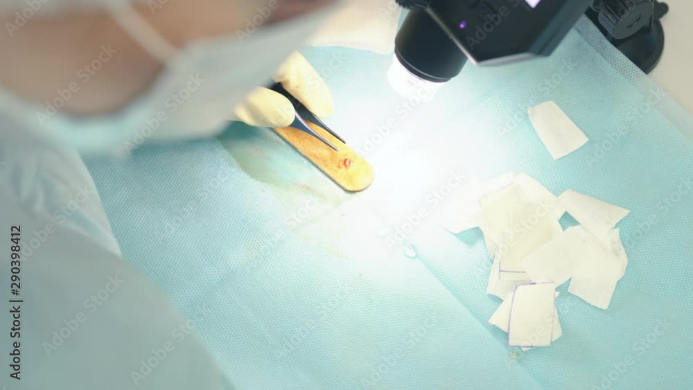 The doctor under the microscope recalculates the hair follicles ...