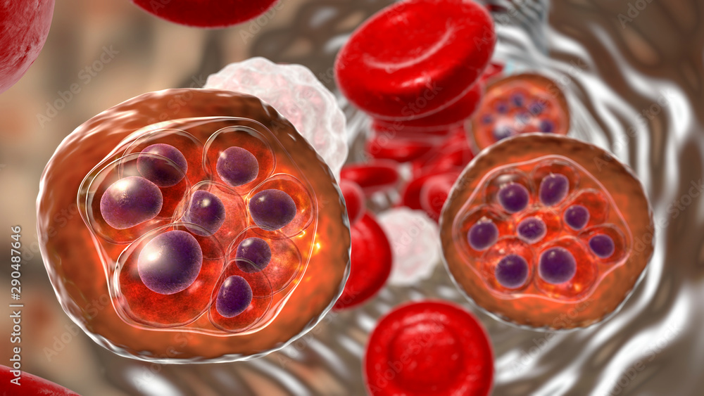 Malaria infection, 3D illustration. Plasmodium parasites inside red ...