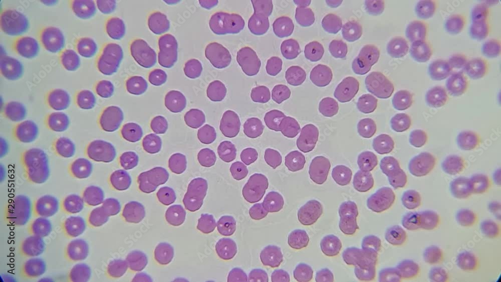 blood smear : Red blood cells from a dog suspected of babesiosis under ...