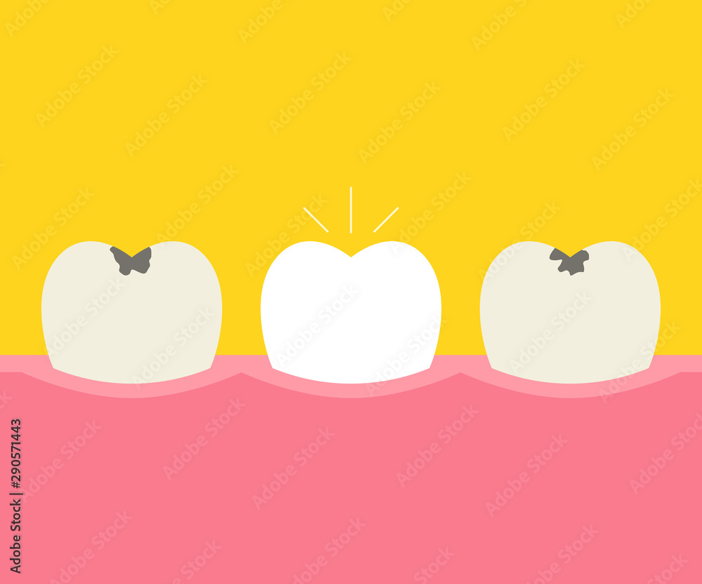 Before and After, whitening oral care concept. Deep cleaning, clearing ...