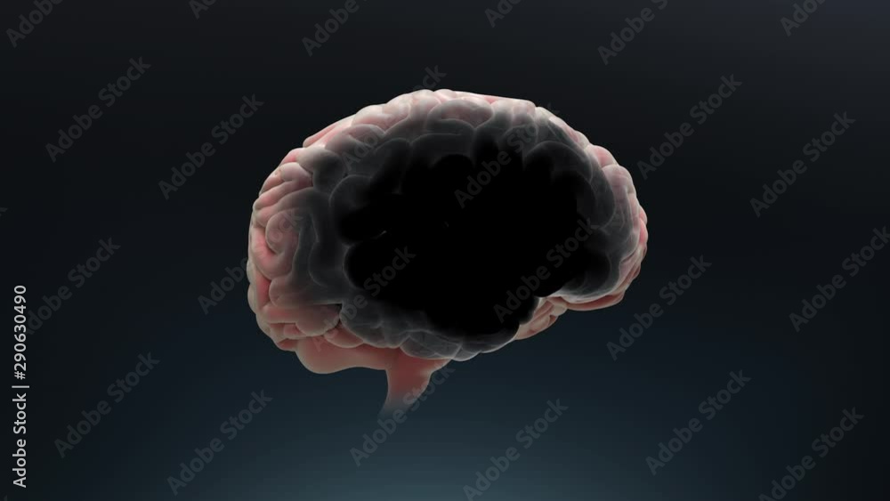 Isolated Brain Rotates with Dark Spots Spreading Showing the Concept of ...