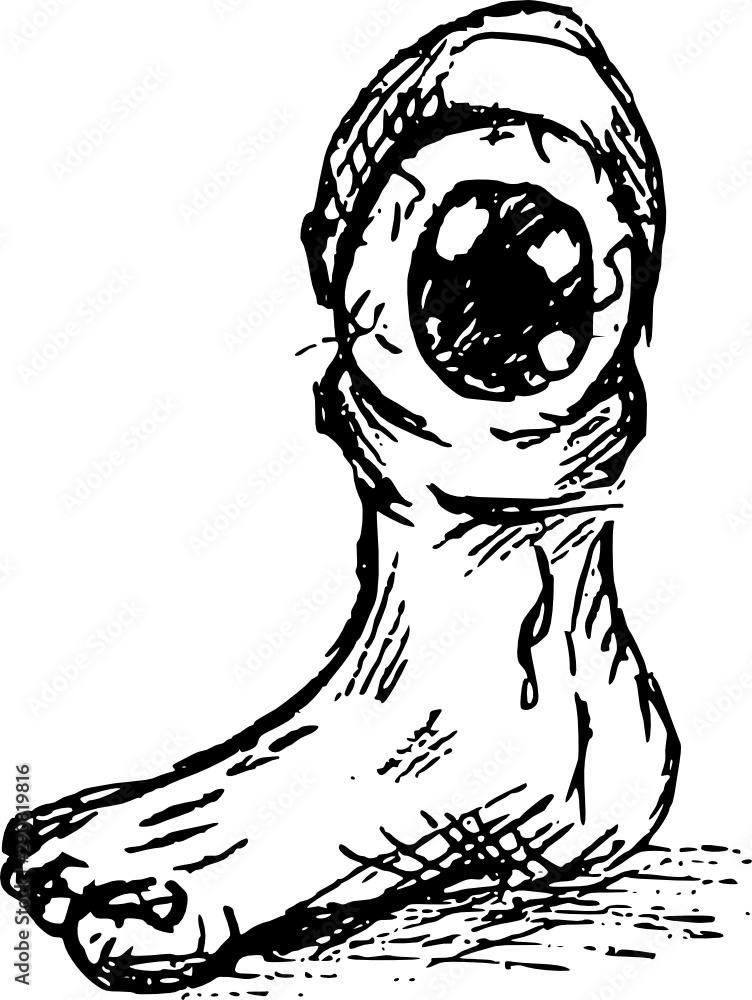 Eye on a foot - artwork drawing in black Stock Vector | Adobe Stock