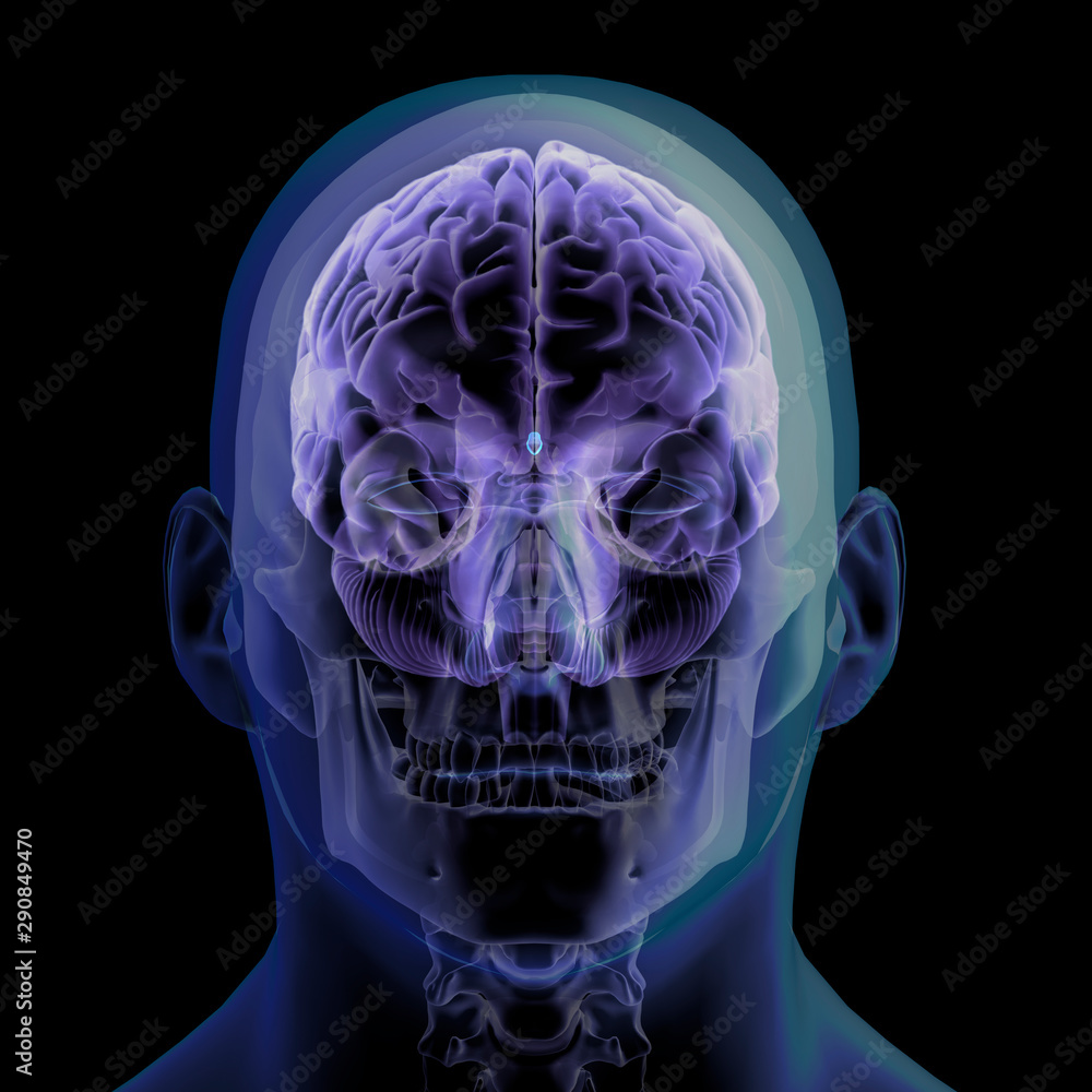 X Ray Brain Front