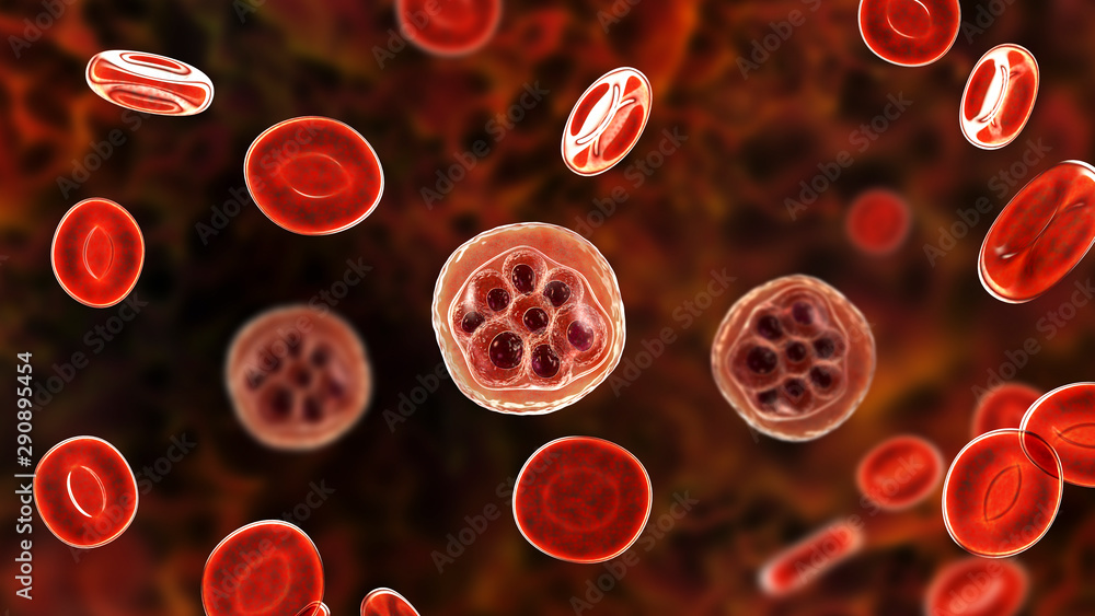 Red blood cells infected with malaria parasite, 3D illustration showing ...