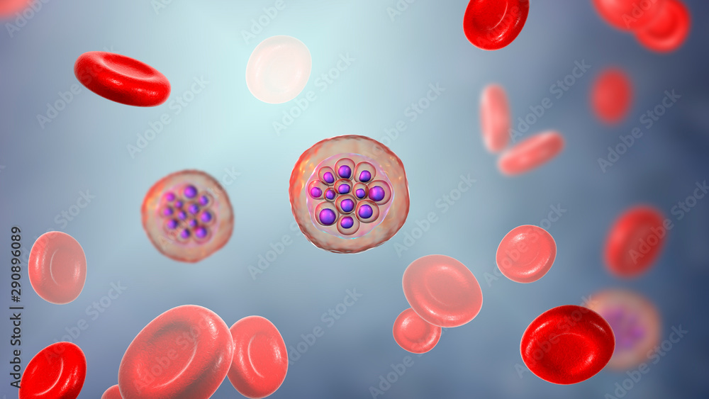 Red blood cells infected with malaria parasite Plasmodium vivax ...