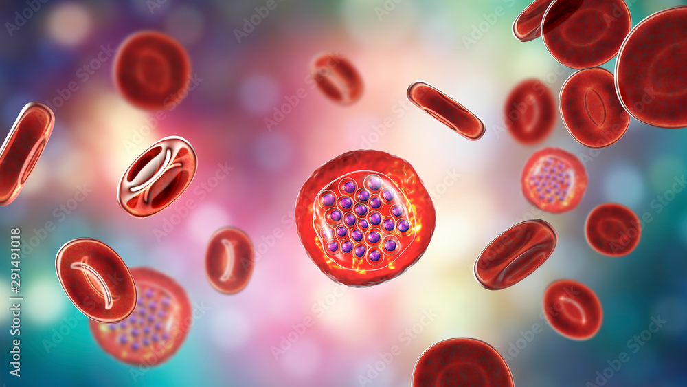The malaria-infected red blood cells. 3D illustration showing malaria ...
