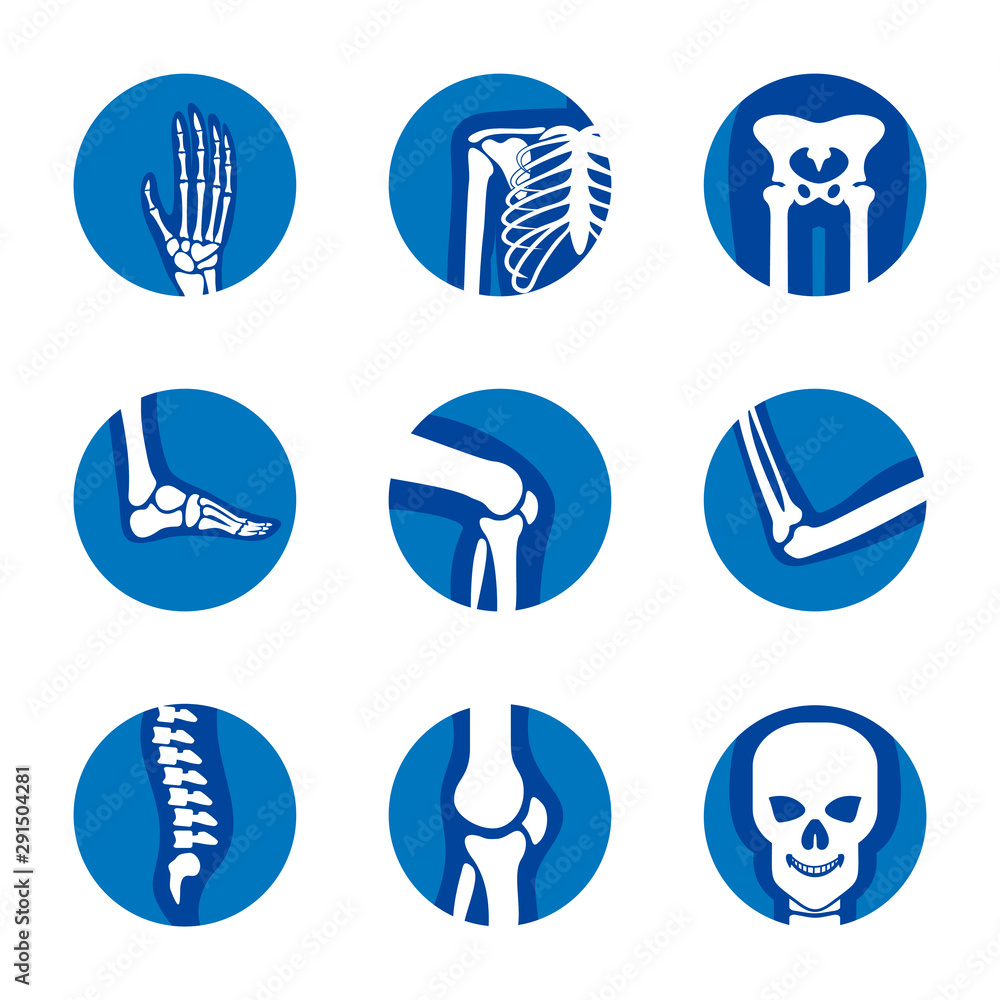 Set of Human bone orthopedic Logo Concept Vector. Bone x-ray image of ...