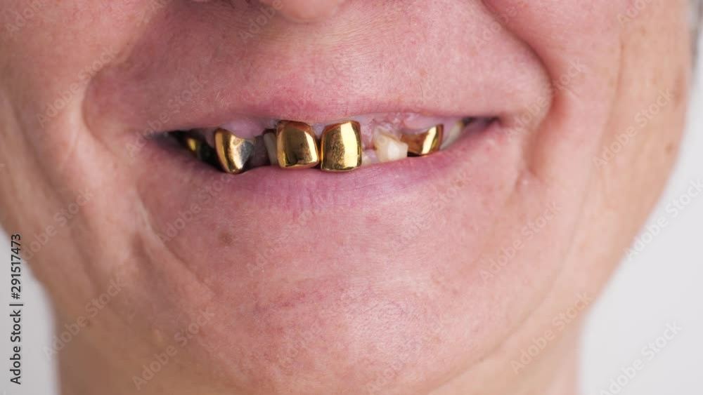 scary toothless smile of an old woman. golden teeth. no teeth. rotten ...