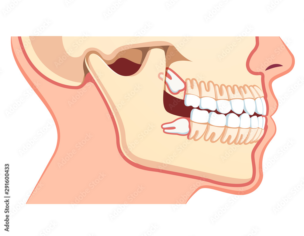 Human jaws model with teeth row. Dentistry Stock Vector | Adobe Stock