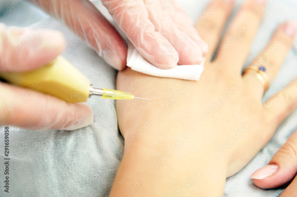 Carbon dioxide therapy (carboxytherapy). Skin rejuvenation. Stock Photo ...