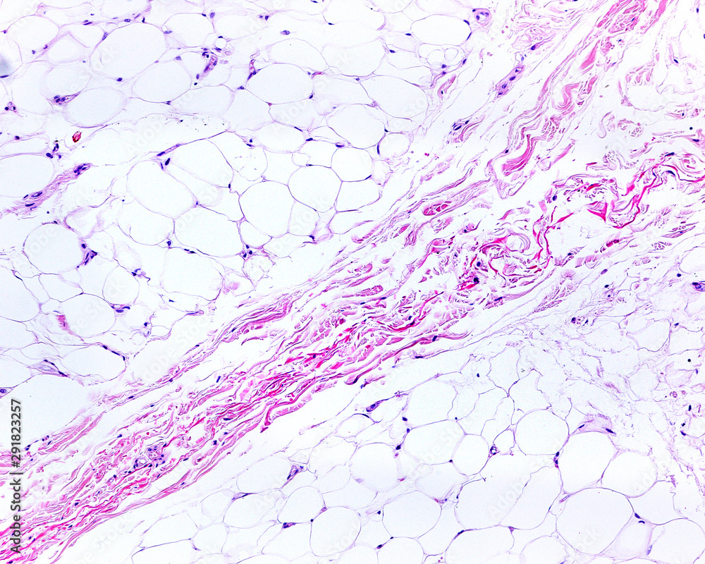 Foto de Subcutaneous adipose tissue. Blood vessels do Stock | Adobe Stock
