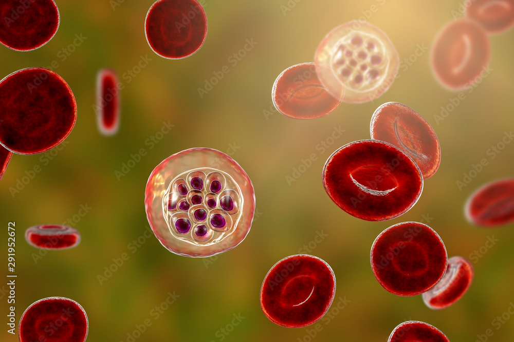 Red blood cells infected with malaria parasite Plasmodium vivax ...