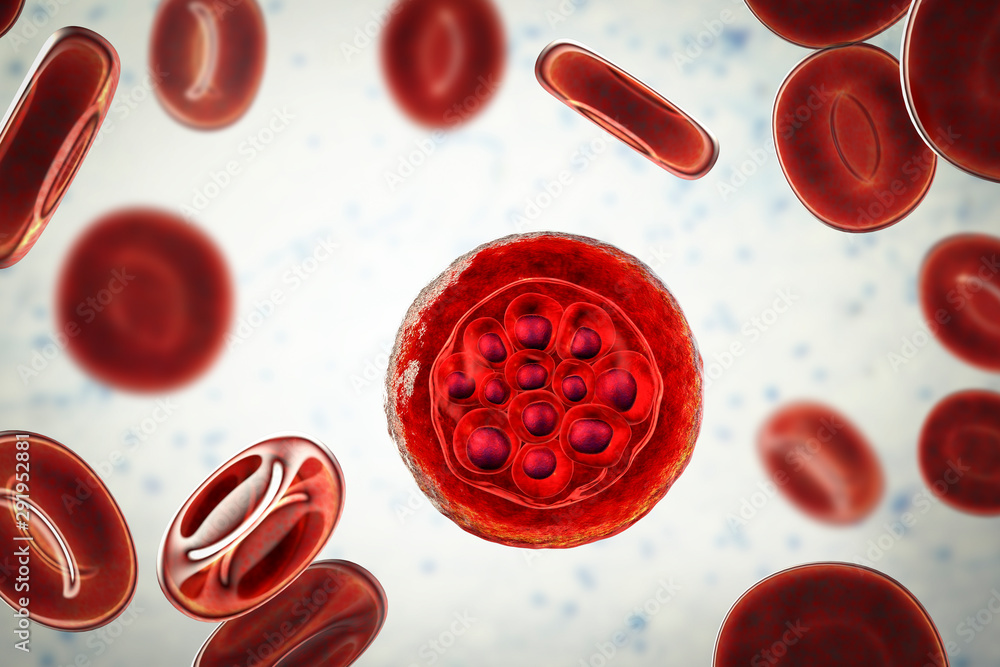 Red blood cell infected with malaria parasite Plasmodium vivax in schizont stage, 3D ...