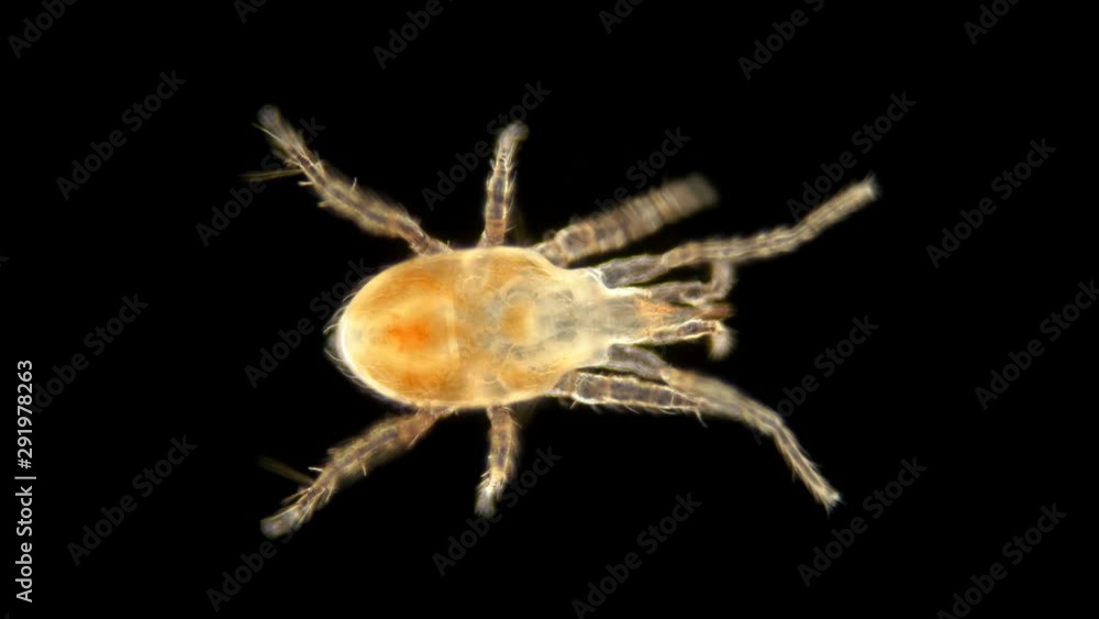 a tick of the order Mesostigmata under a microscope, class Arachnida ...