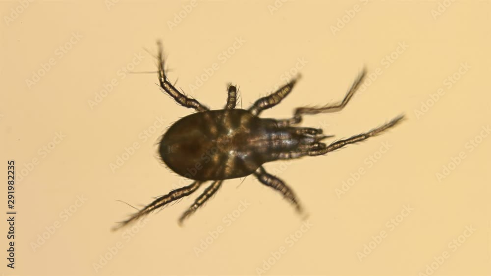 a tick of the order Mesostigmata under a microscope, class Arachnida ...