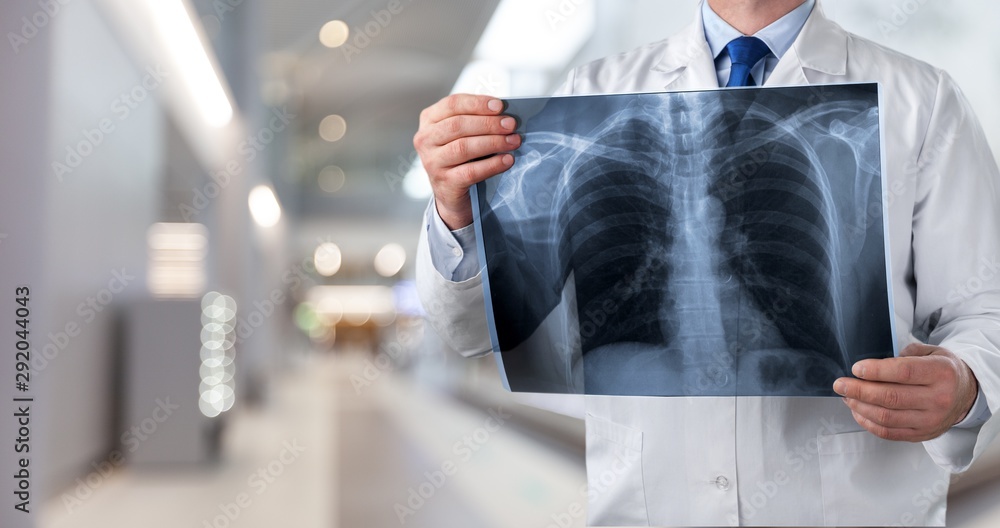 lung radiography concept. radiology doctor examining at chest x ray ...