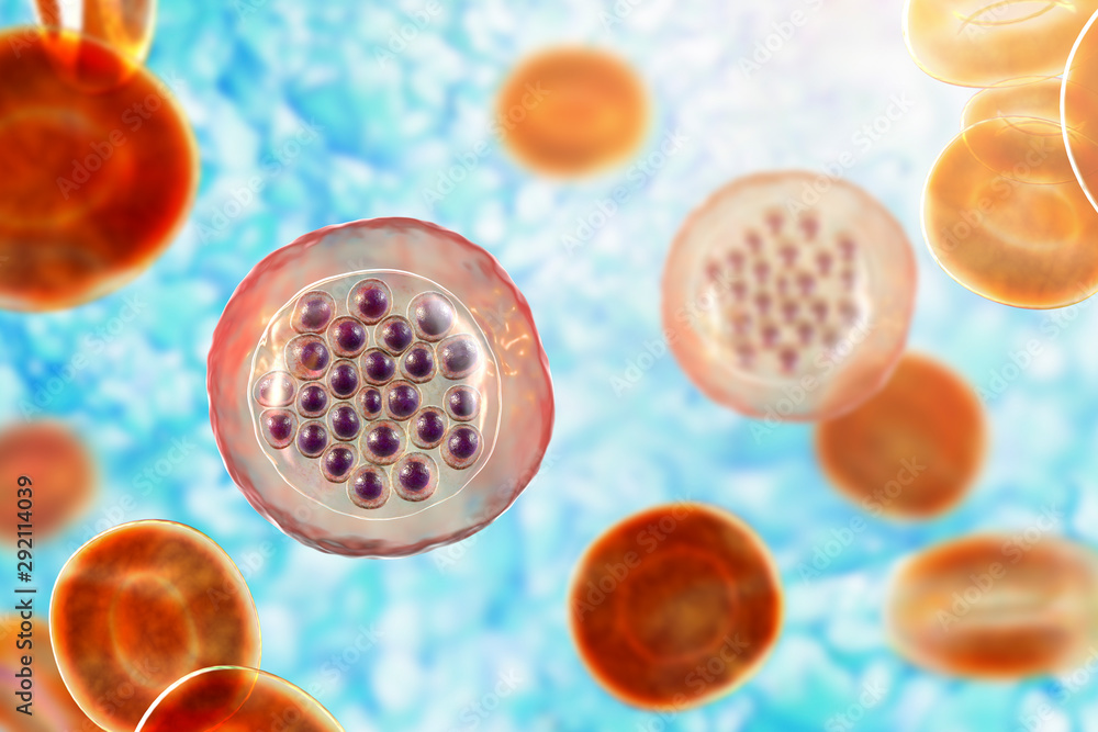 The malaria-infected red blood cells. 3D illustration showing malaria ...