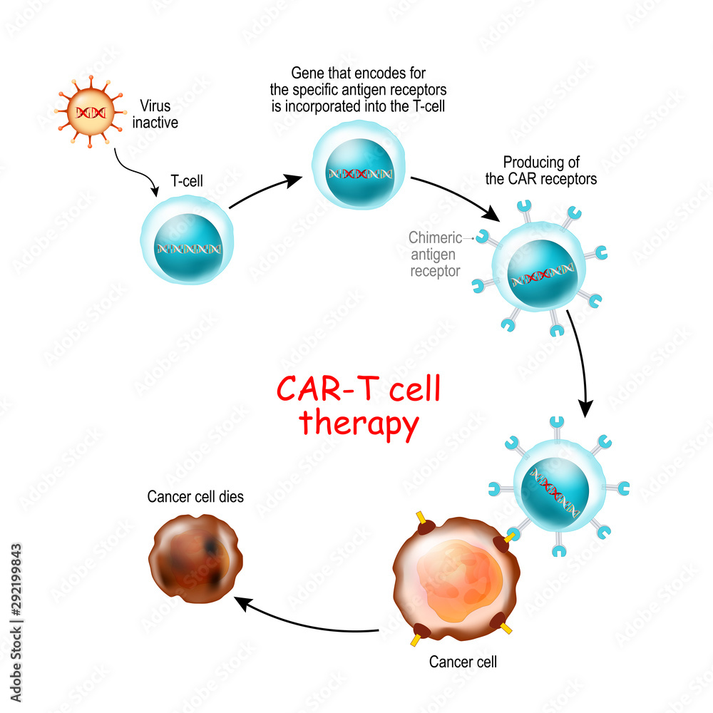 CAR T-cell therapy Stock Vector | Adobe Stock