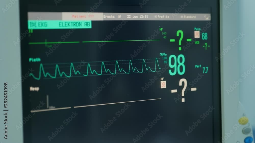 the device shows vital signs to the doctor Stock Video | Adobe Stock