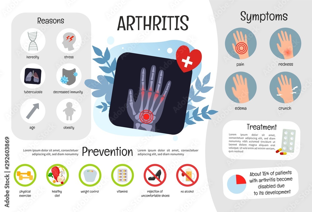 Vector medical poster arthritis. Symptoms of the disease. Prevention. X ...