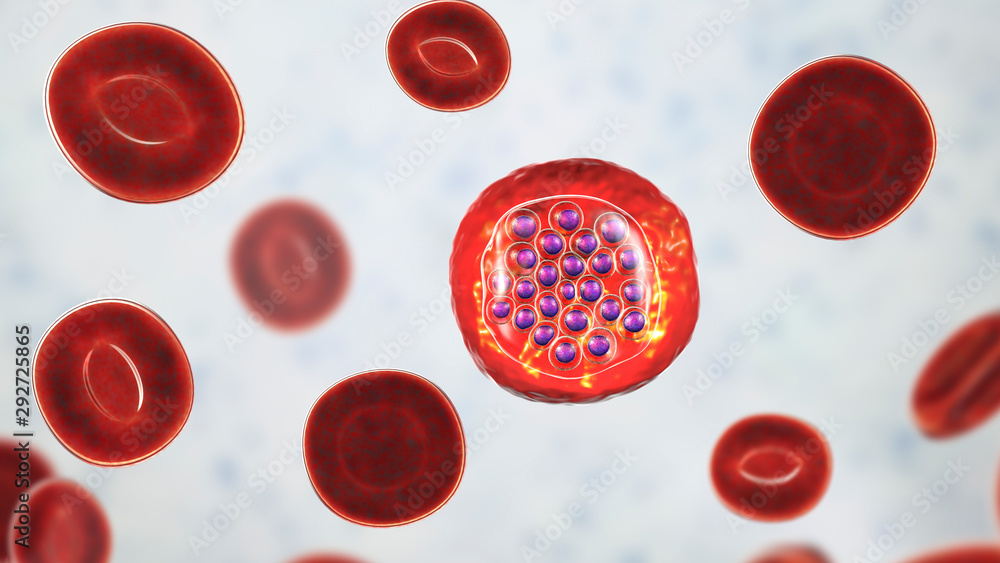 The malaria-infected red blood cells. 3D illustration showing malaria ...