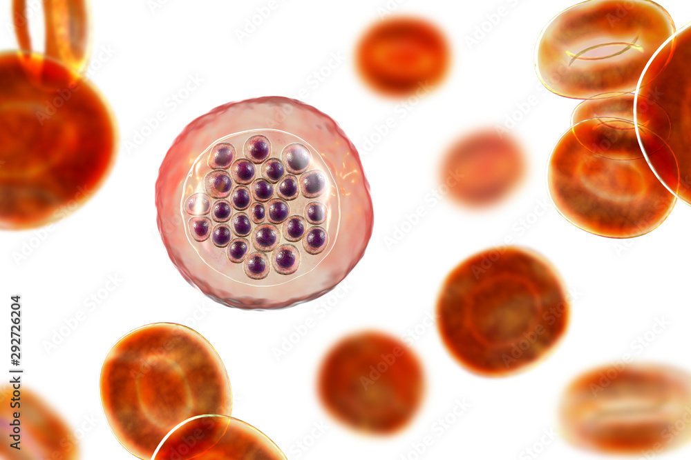 The malaria-infected red blood cells. 3D illustration showing malaria ...