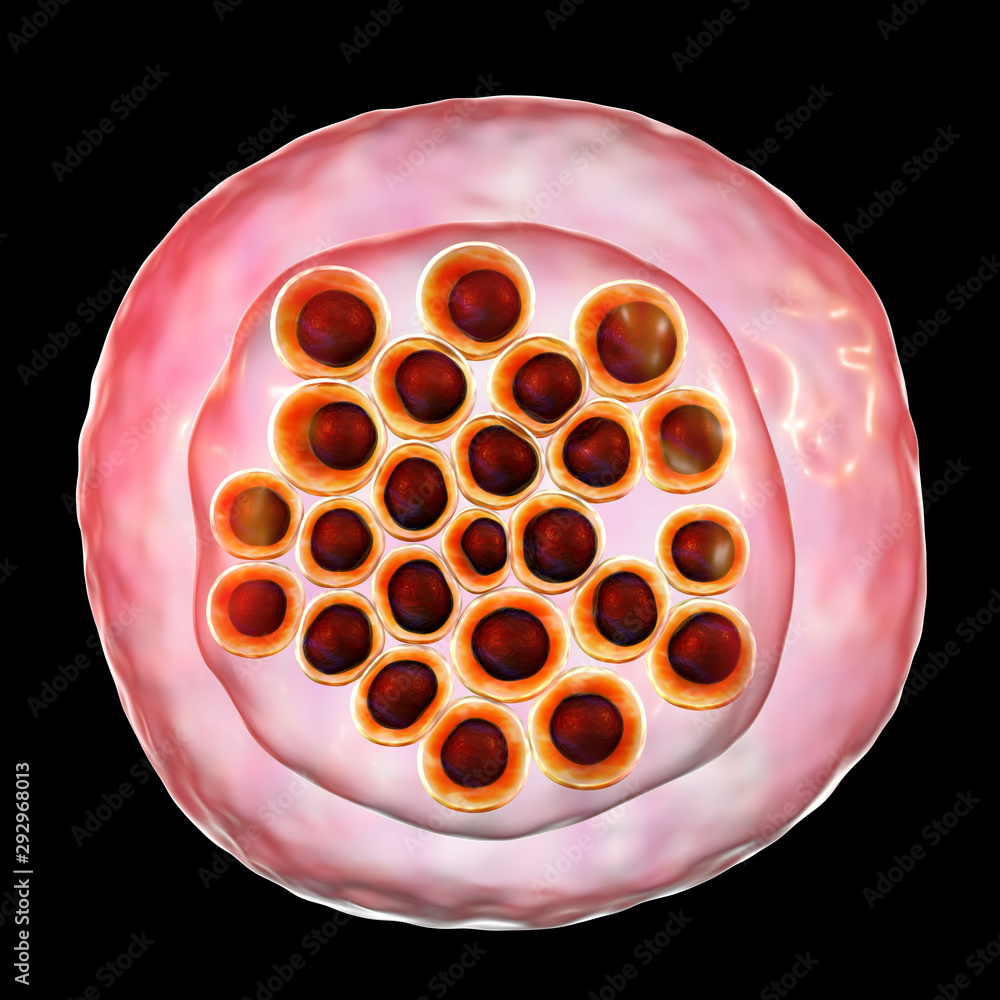 The malaria-infected red blood cell. 3D illustration showing malaria ...